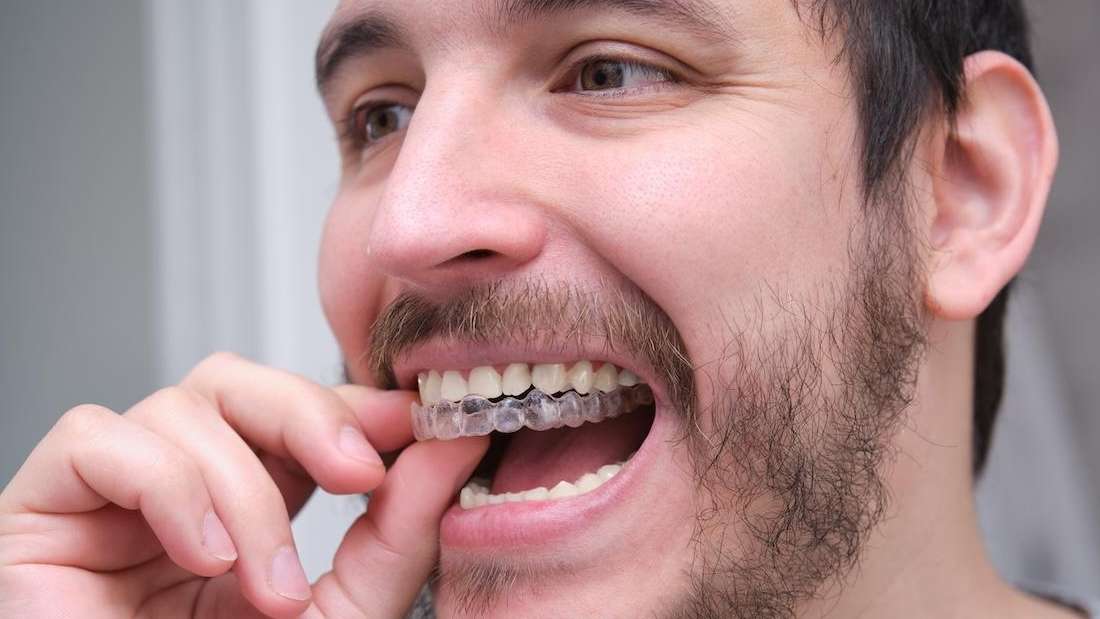 The Role Of Orthodontics In Improving Your Smile In Jonesboro